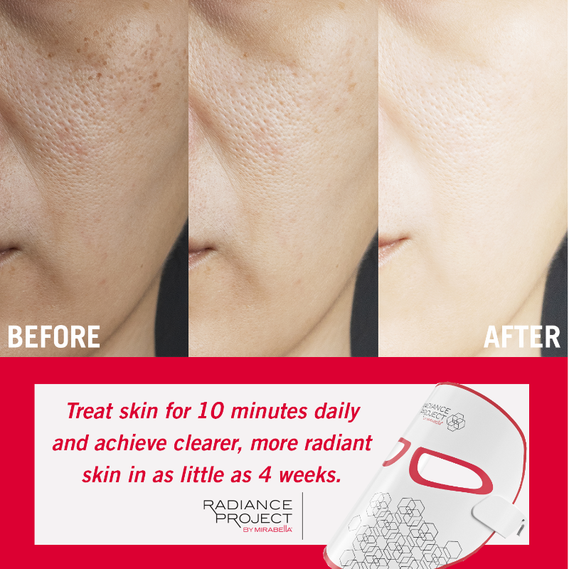 Mirabella Phototherapy 7-Color LED Facial Mask with Near Infrared